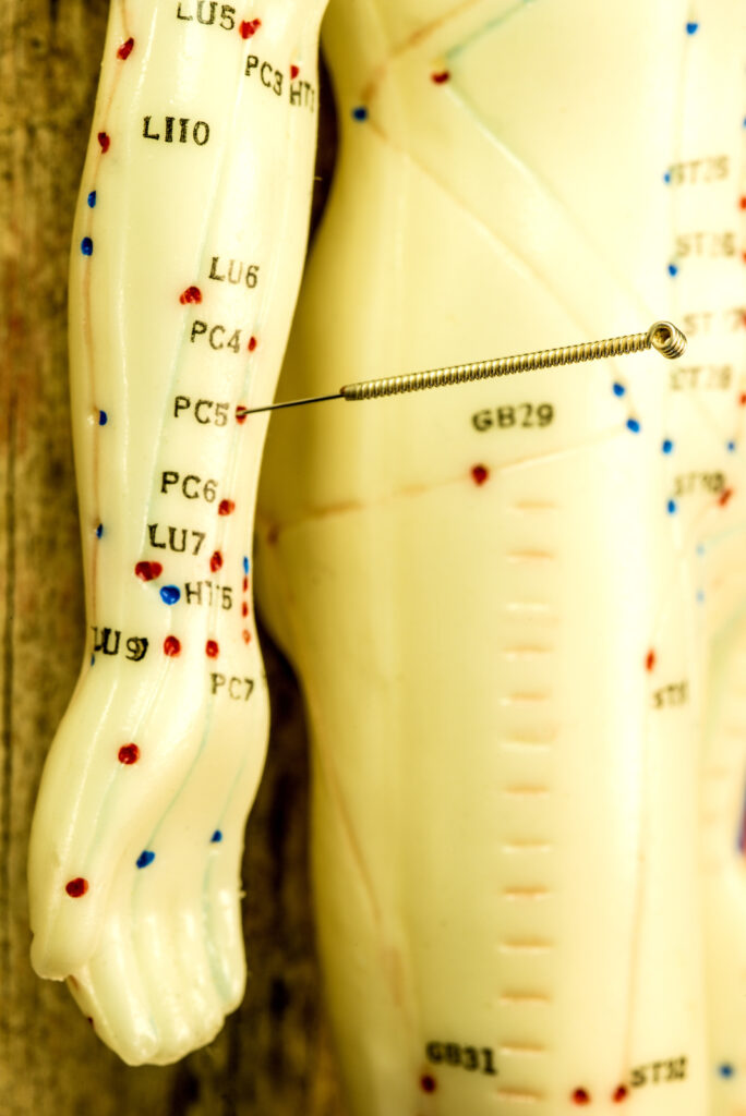 Distance Acupuncture - Lance Lee Acupuncture